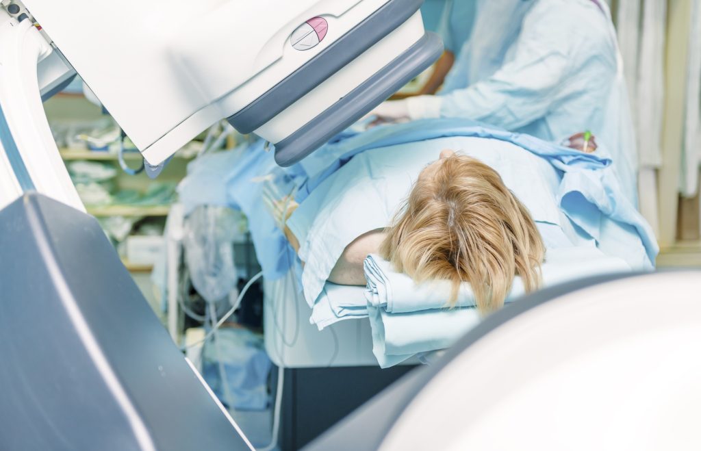 What to expect before UFE procedure? | Fibroid Embolization